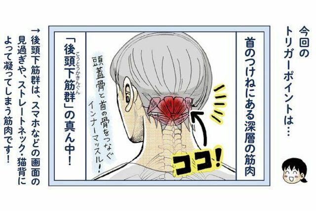 眼精疲労による肩こり、頭痛・めまいの緩和に。首こり&目の疲れのトリガーポイントって何?【崎田ミナのつかれにピンポイント!】 Antenna